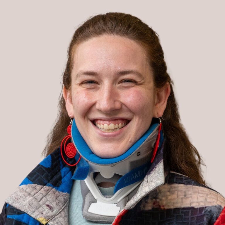 Patient Perspectives: Ehlers Danlos Syndrome with Emily Rubenstein ...